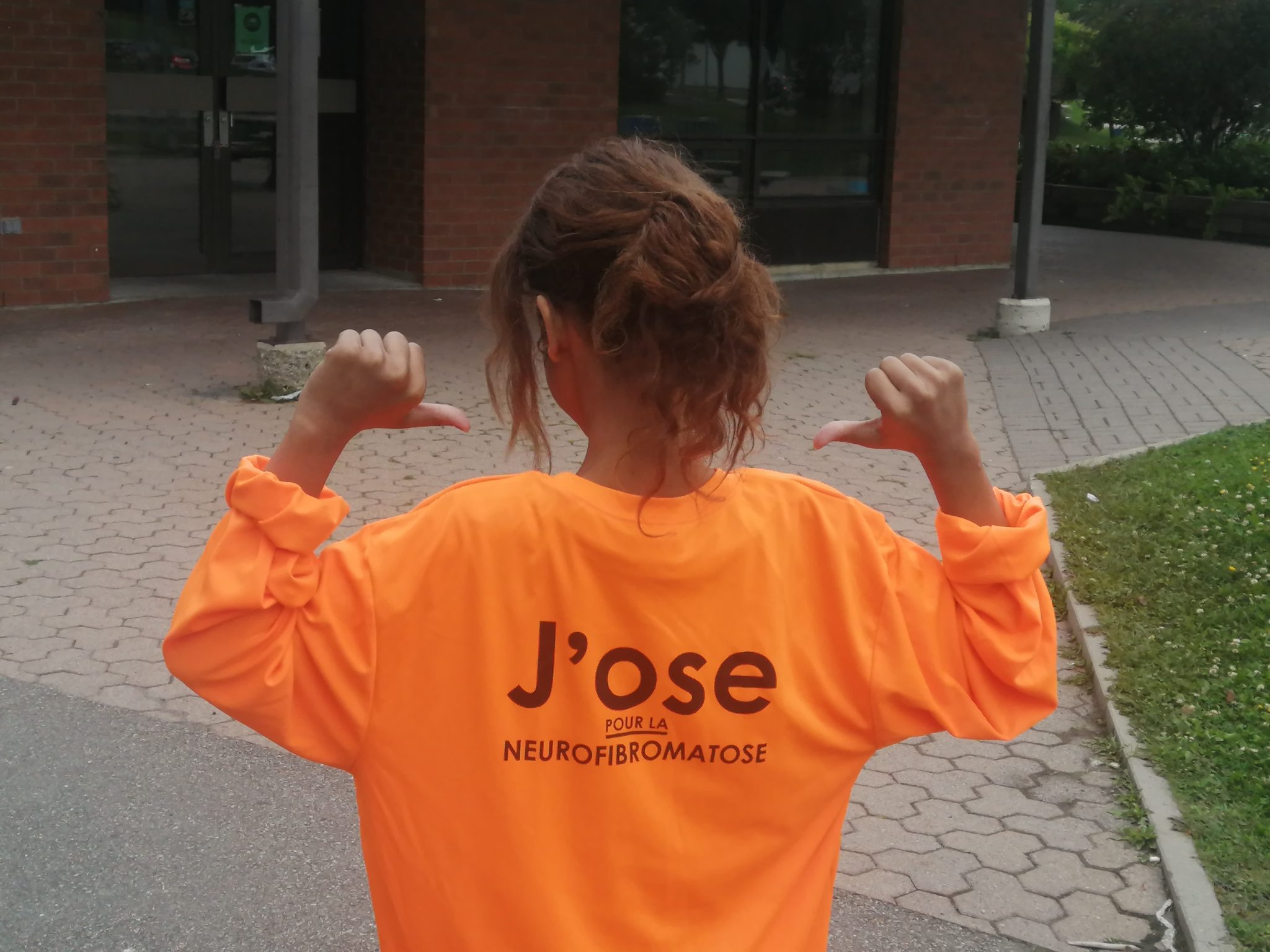 Jade Morin atteinte d’une maladie rare : la neurofibromatose | Journal ...